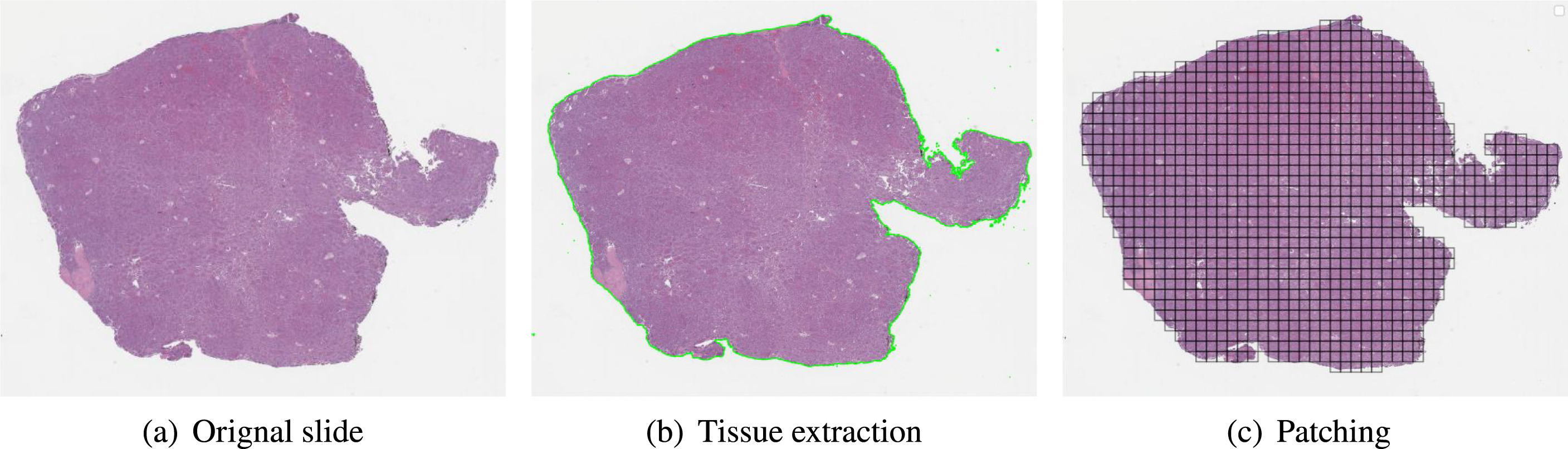 Eswa 2023 Promil A Weakly Supervised Multiple Instance Learning For